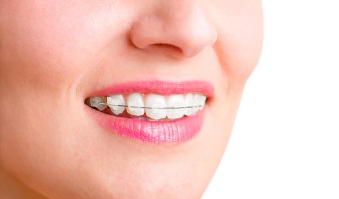 types-of-restorative-dentistry